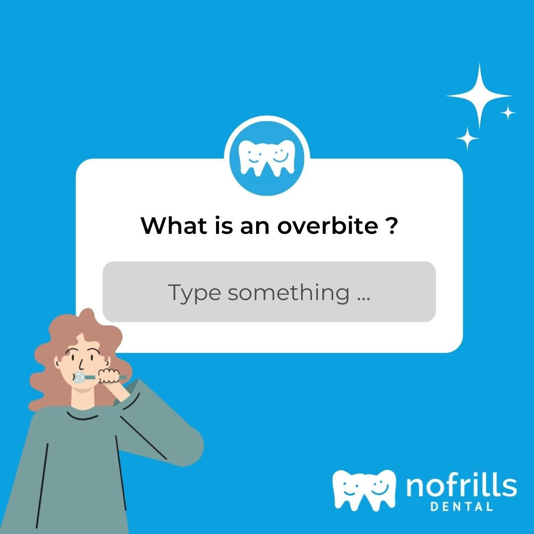 What is an overbite? How do I fix an overbite?